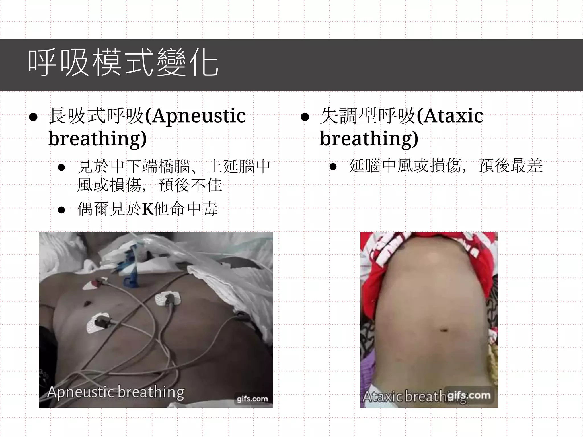 基礎急重症神經學檢查 | PPTX