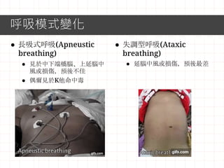 基礎急重症神經學檢查 | PPTX