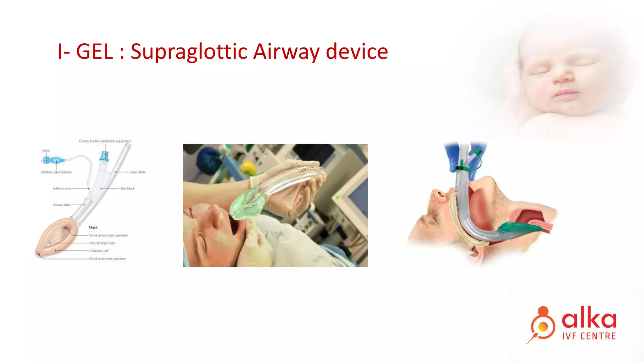 Emergency Obstetrics | PPT