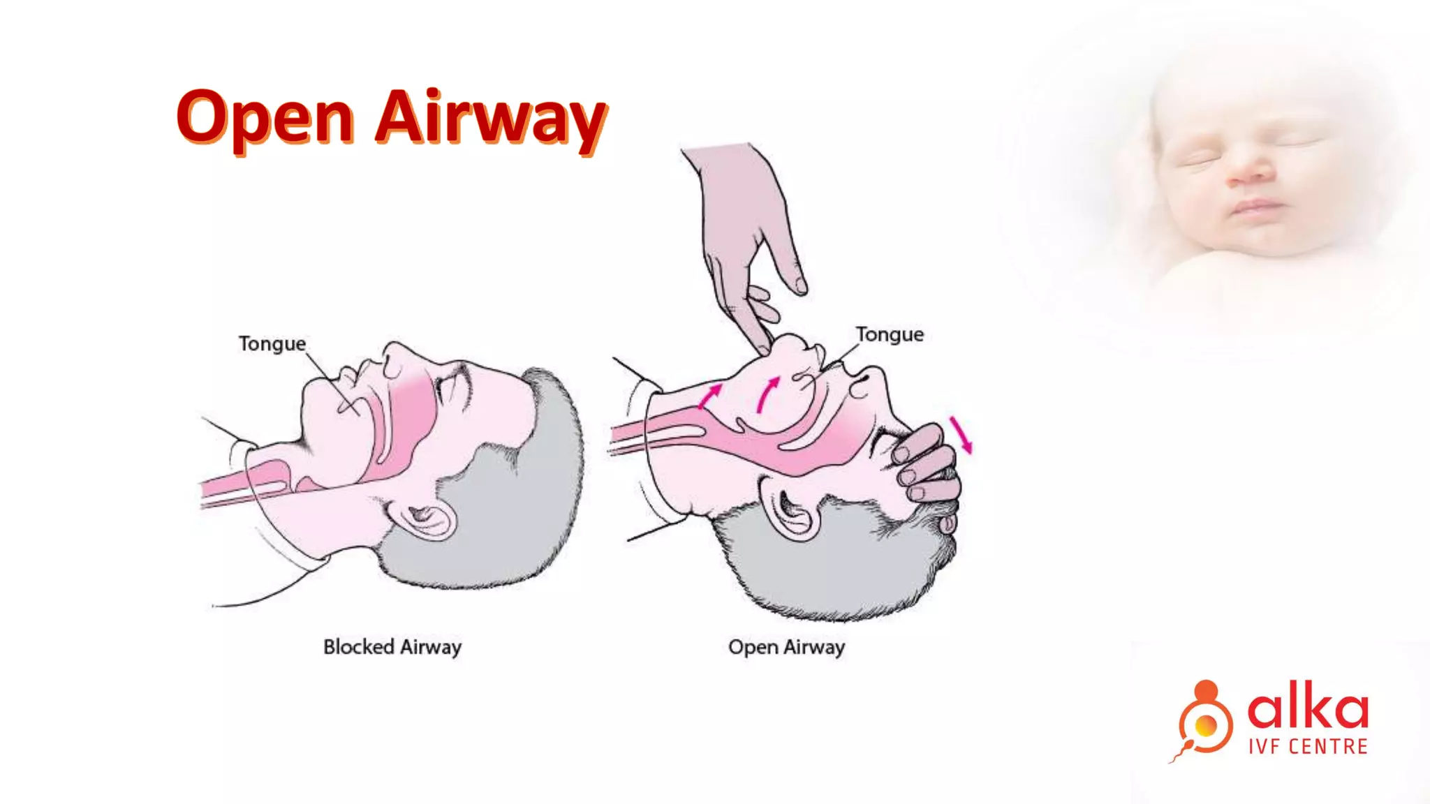 Emergency Obstetrics | PPT