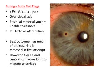 Emergency ophthalmology | PPTX