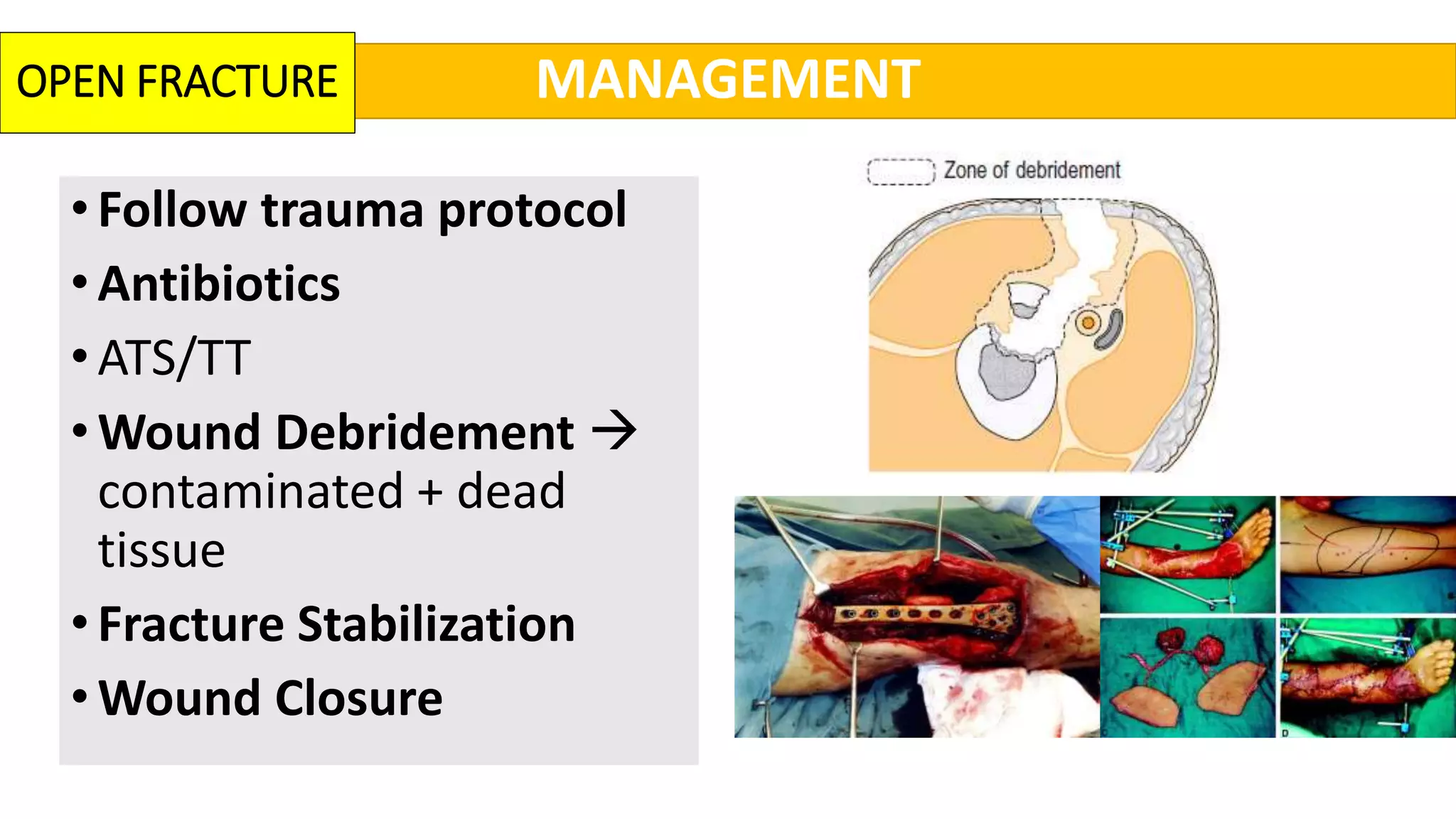 emergency ortopedi .pptx