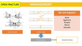 emergency ortopedi .pptx