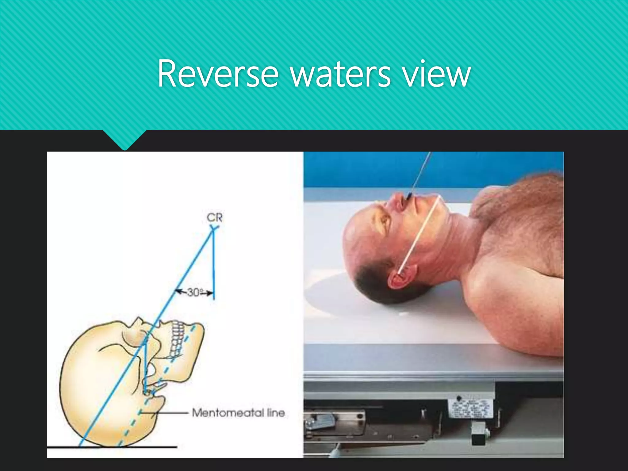 Emergency radiography | PPTX