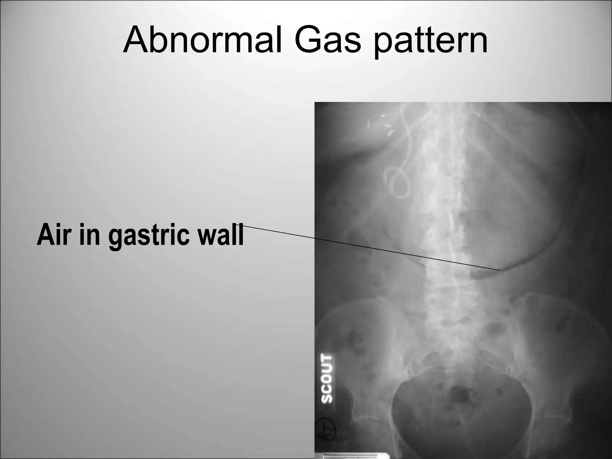 Emergency Radiology in Surgery .ppt
