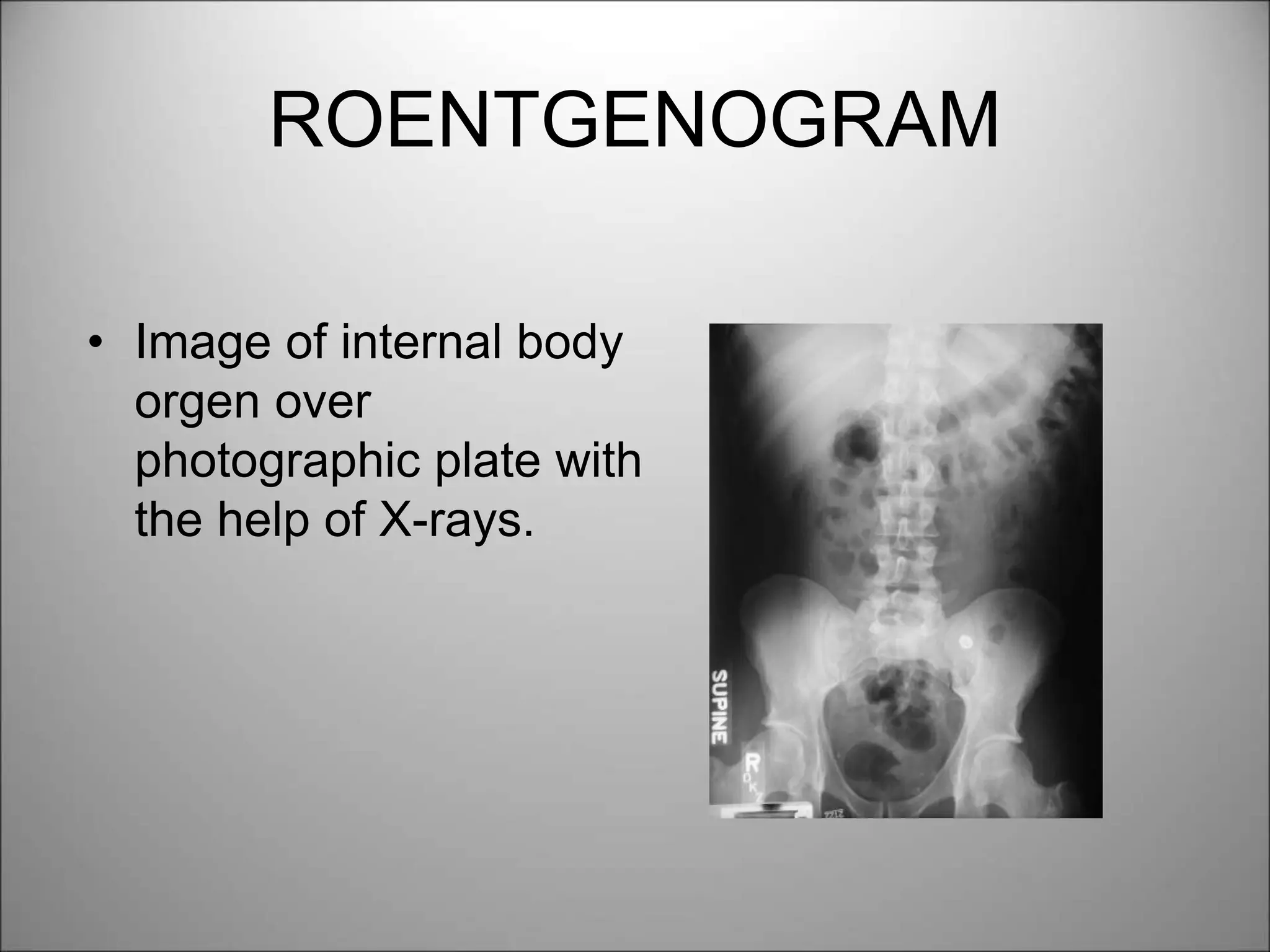 Emergency Radiology in Surgery .ppt