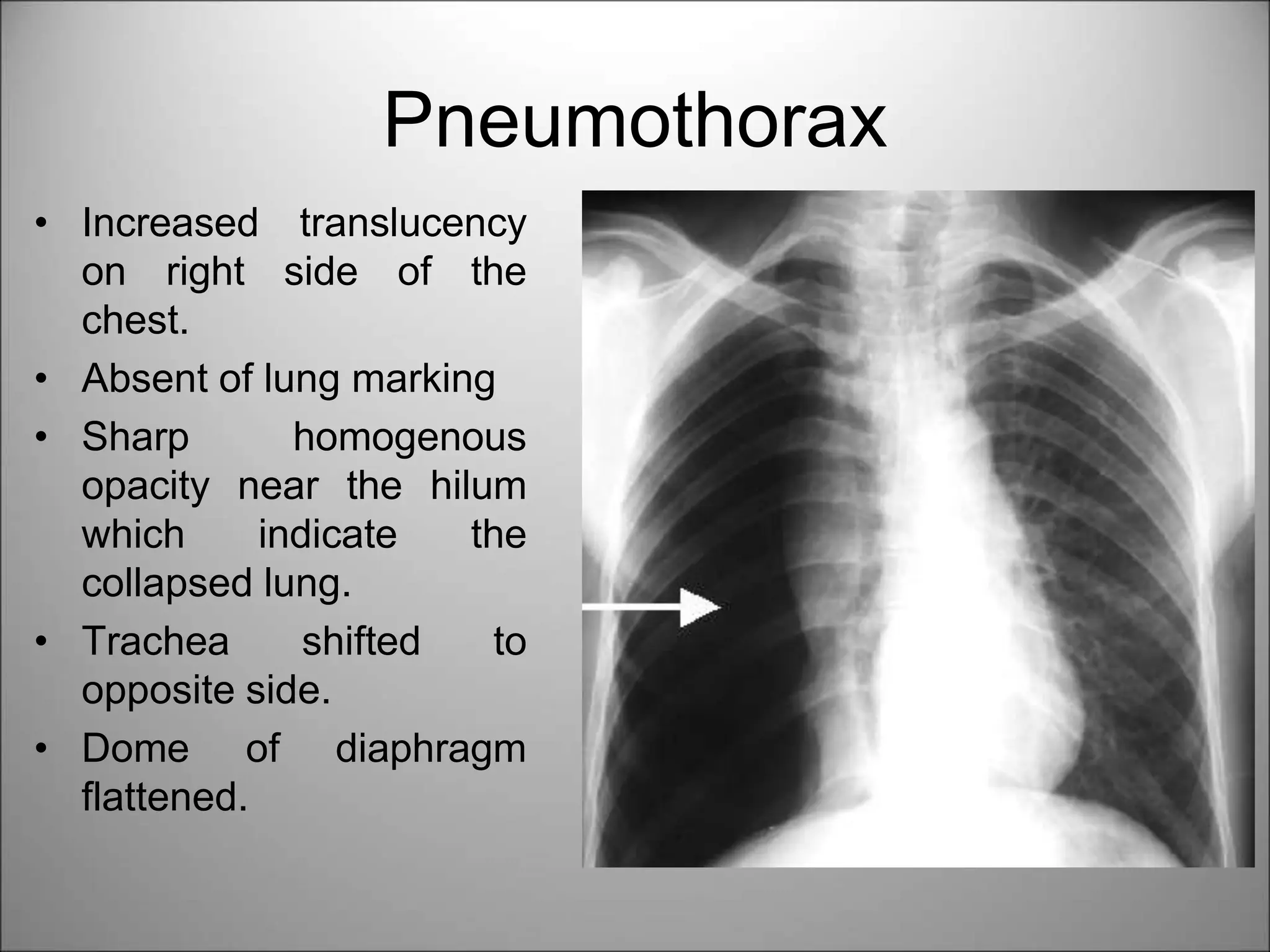 Emergency Radiology in Surgery .ppt