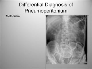 Emergency Radiology in Surgery .ppt