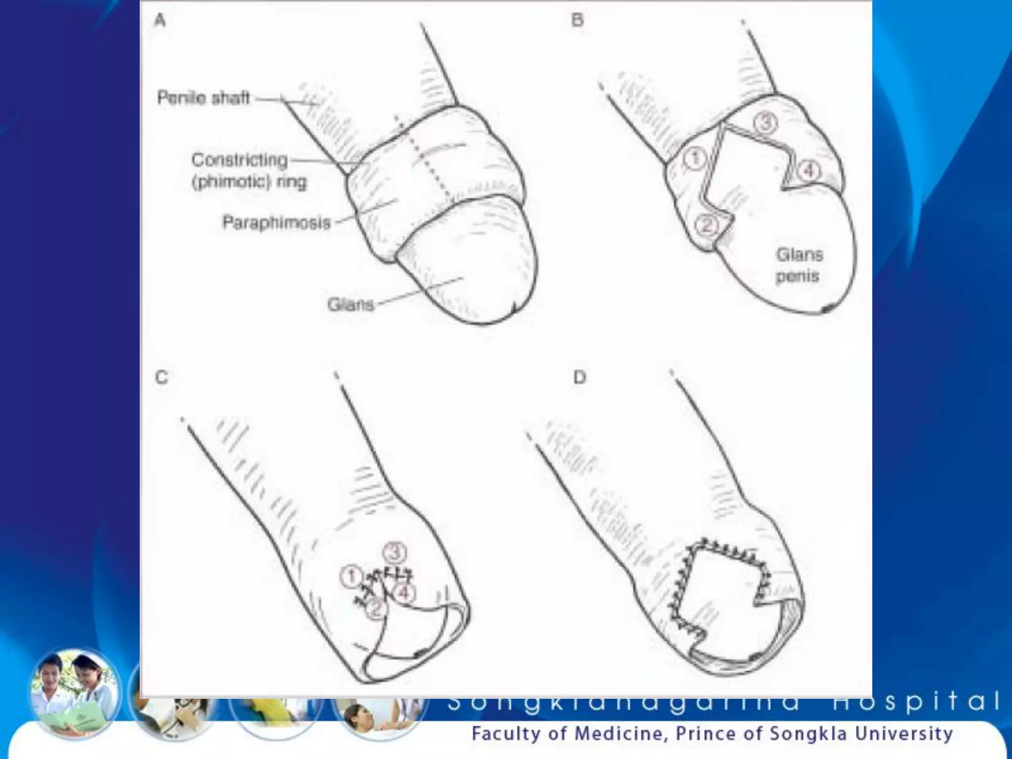 Emergency surgical procedures | PDF