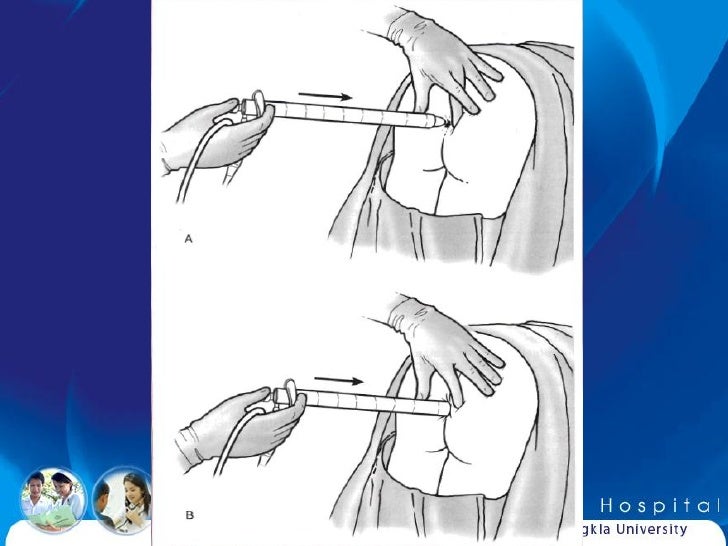 Emergency surgical procedures