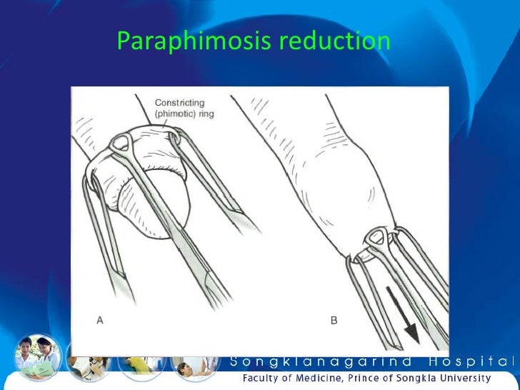 Emergency surgical procedures
