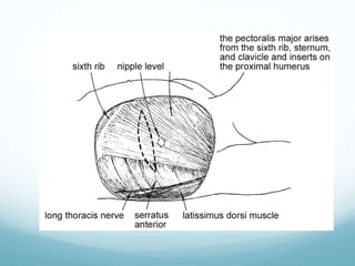 Emergency Thoracotomy | PPT
