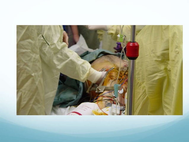 Emergency Thoracotomy | PPT