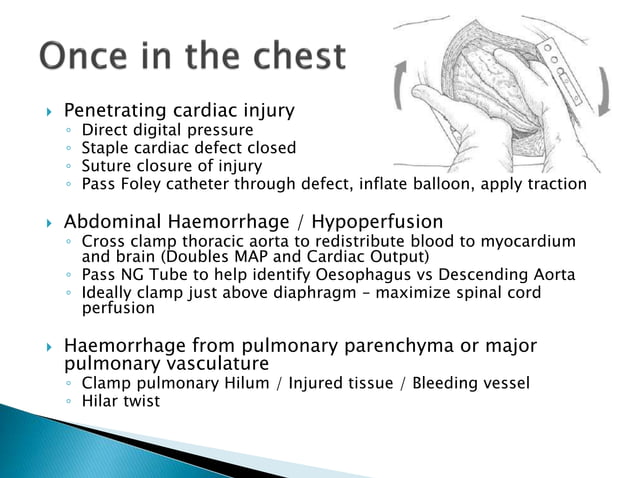 Emergencythoracotomy 151105053500-lva1-app6892 | PPT