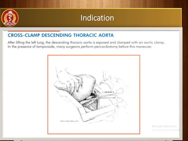 Emergency Thoracotomy | PPT