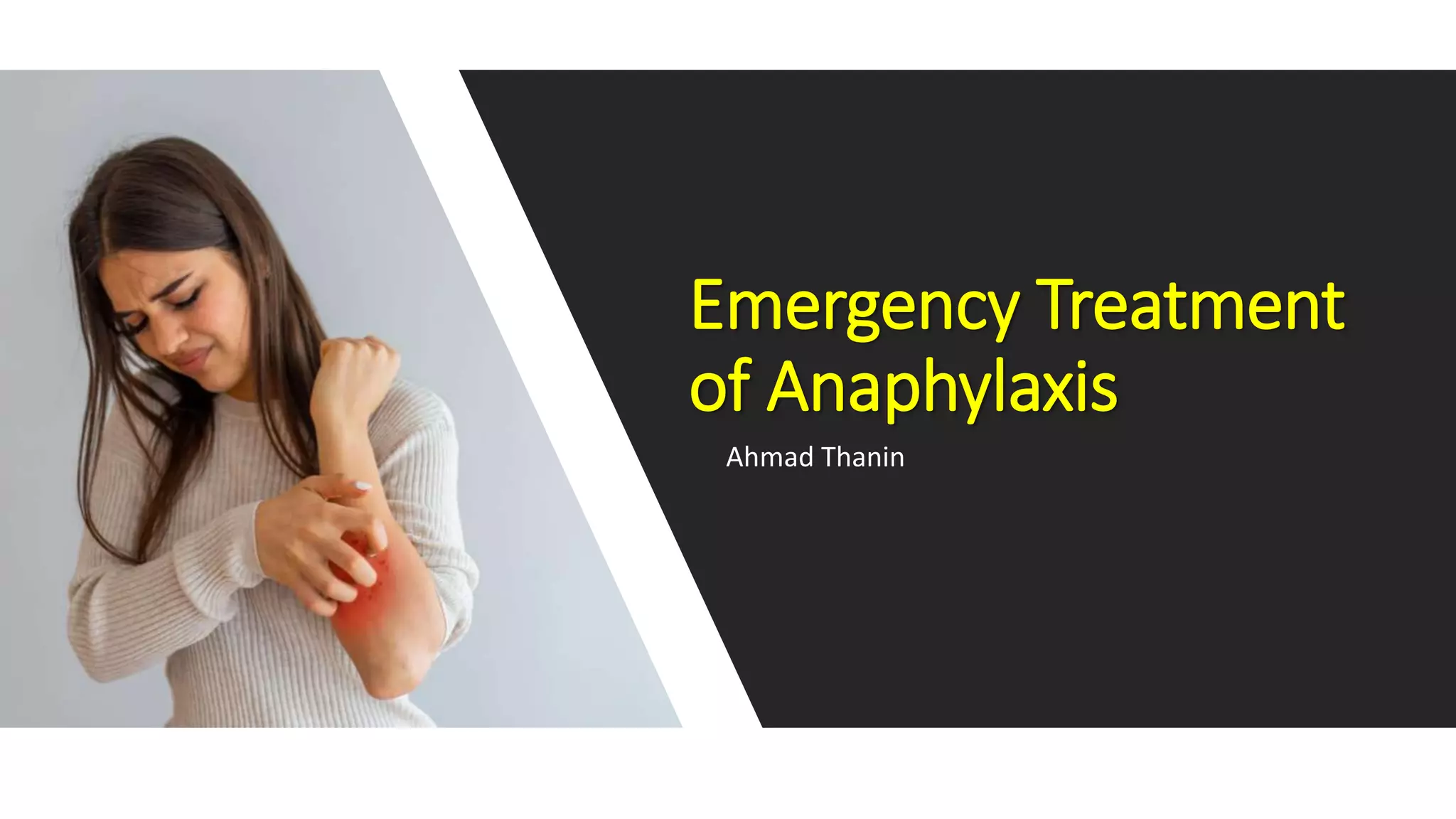 Emergency treatment of anaphylaxis | PPTX