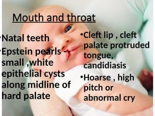 Emergency triage neonatal unit, important | PPT