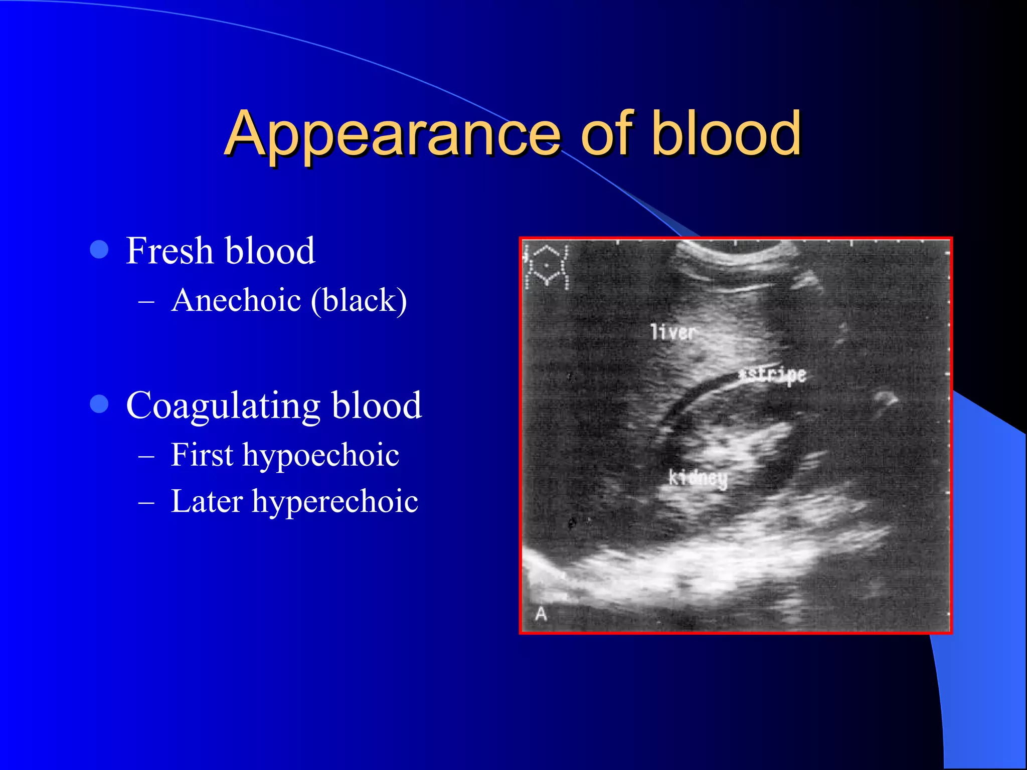 Emergency Ultrasound In Trauma | PPT