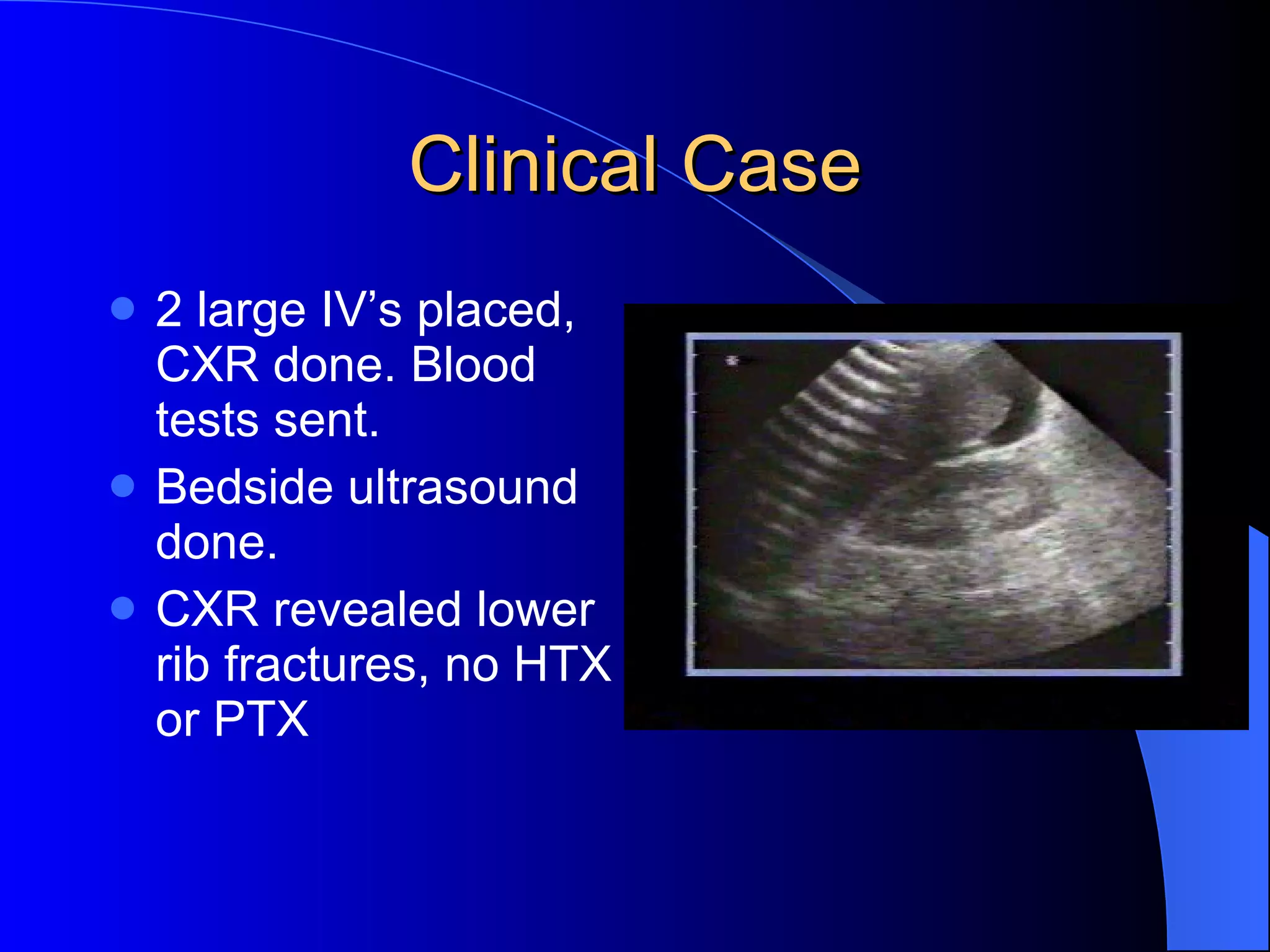 Emergency Ultrasound In Trauma | PPT