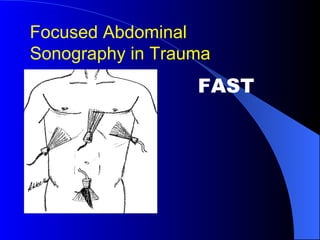 Emergency Ultrasound In Trauma | PPT