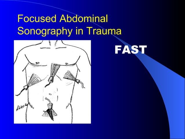 Emergency Ultrasound In Trauma | PPT | First Aid | Injuries