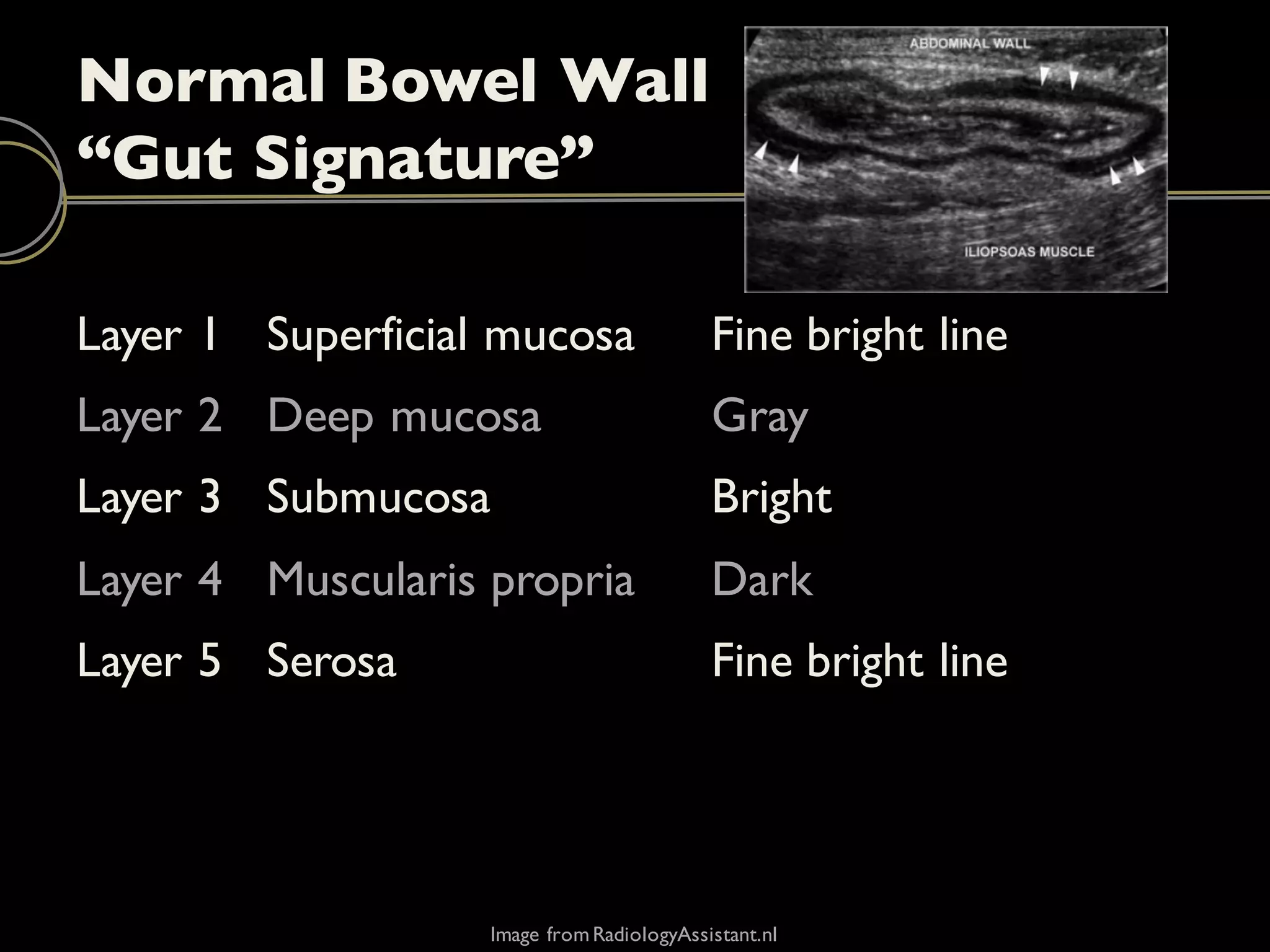 Emergency Ultrasound: Bowel | PDF