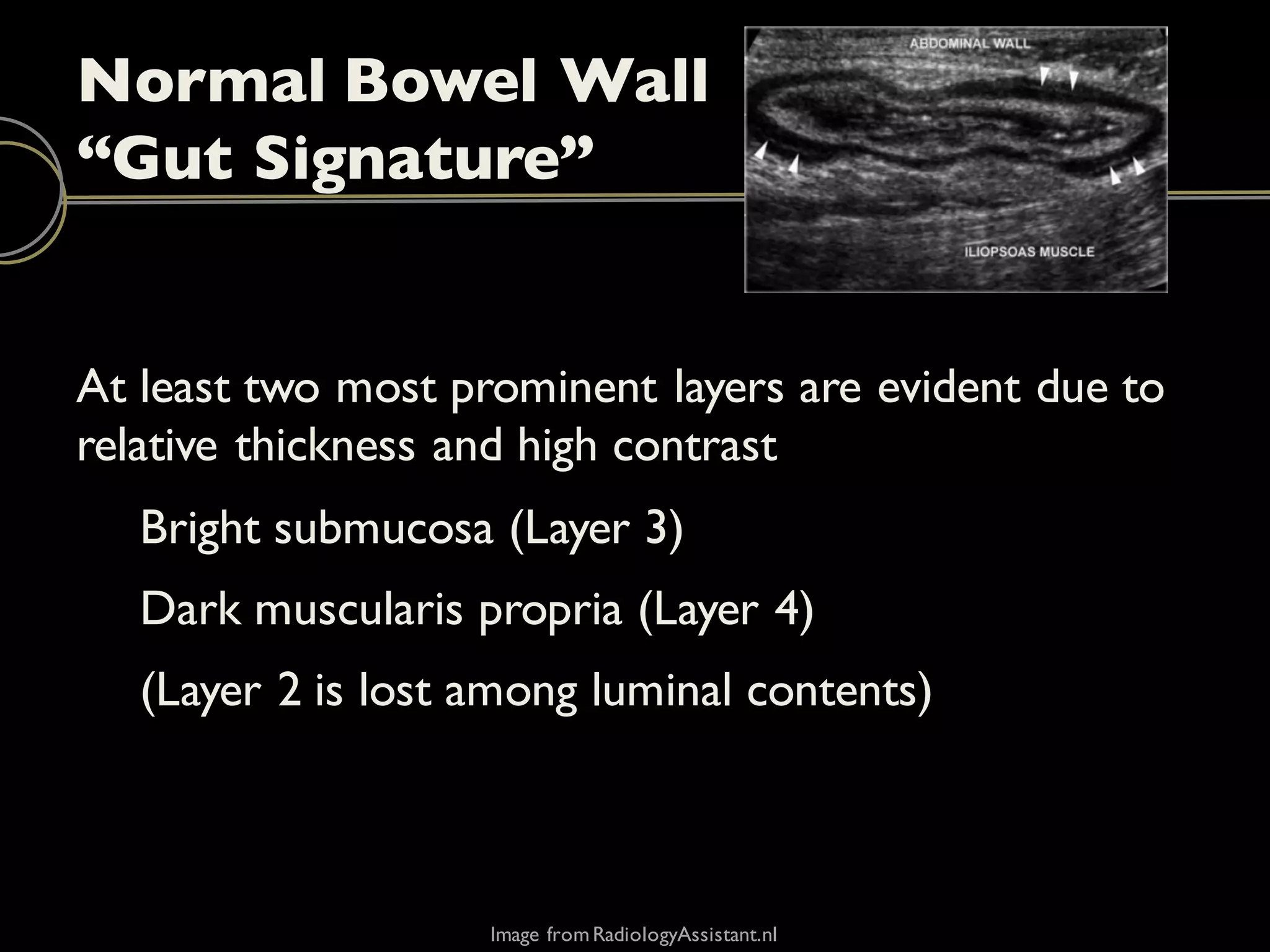 Emergency Ultrasound: Bowel | PDF