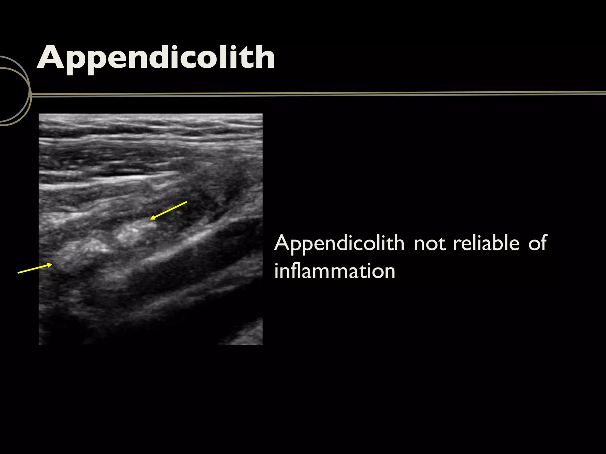 Emergency Ultrasound: Bowel | PDF