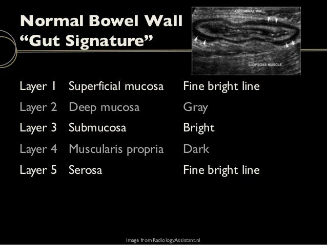 Emergency Ultrasound: Bowel