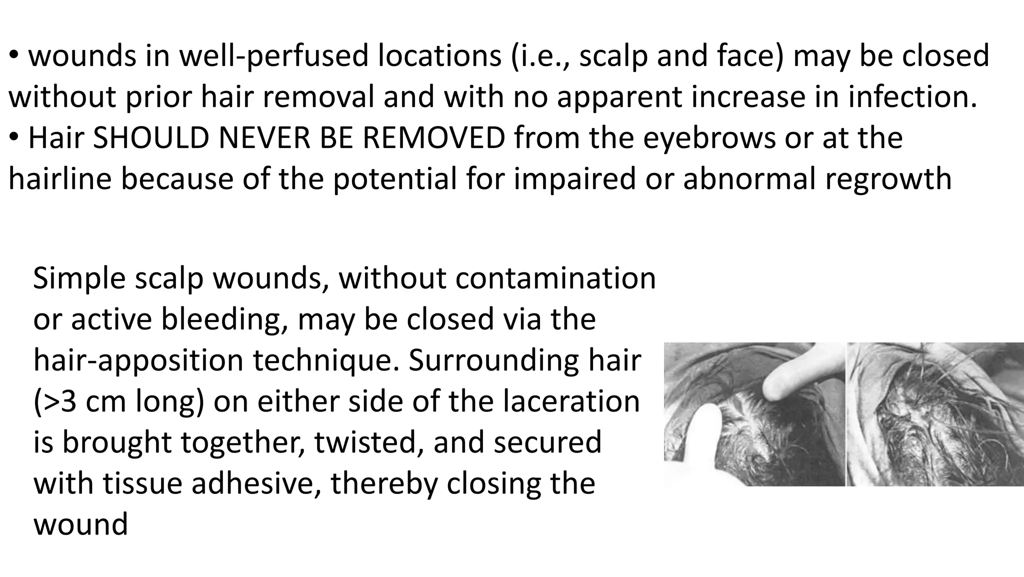 Emergency Wound Management | PPTX