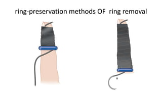 Emergency Wound Management | PPTX