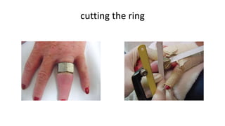 Emergency Wound Management | PPTX