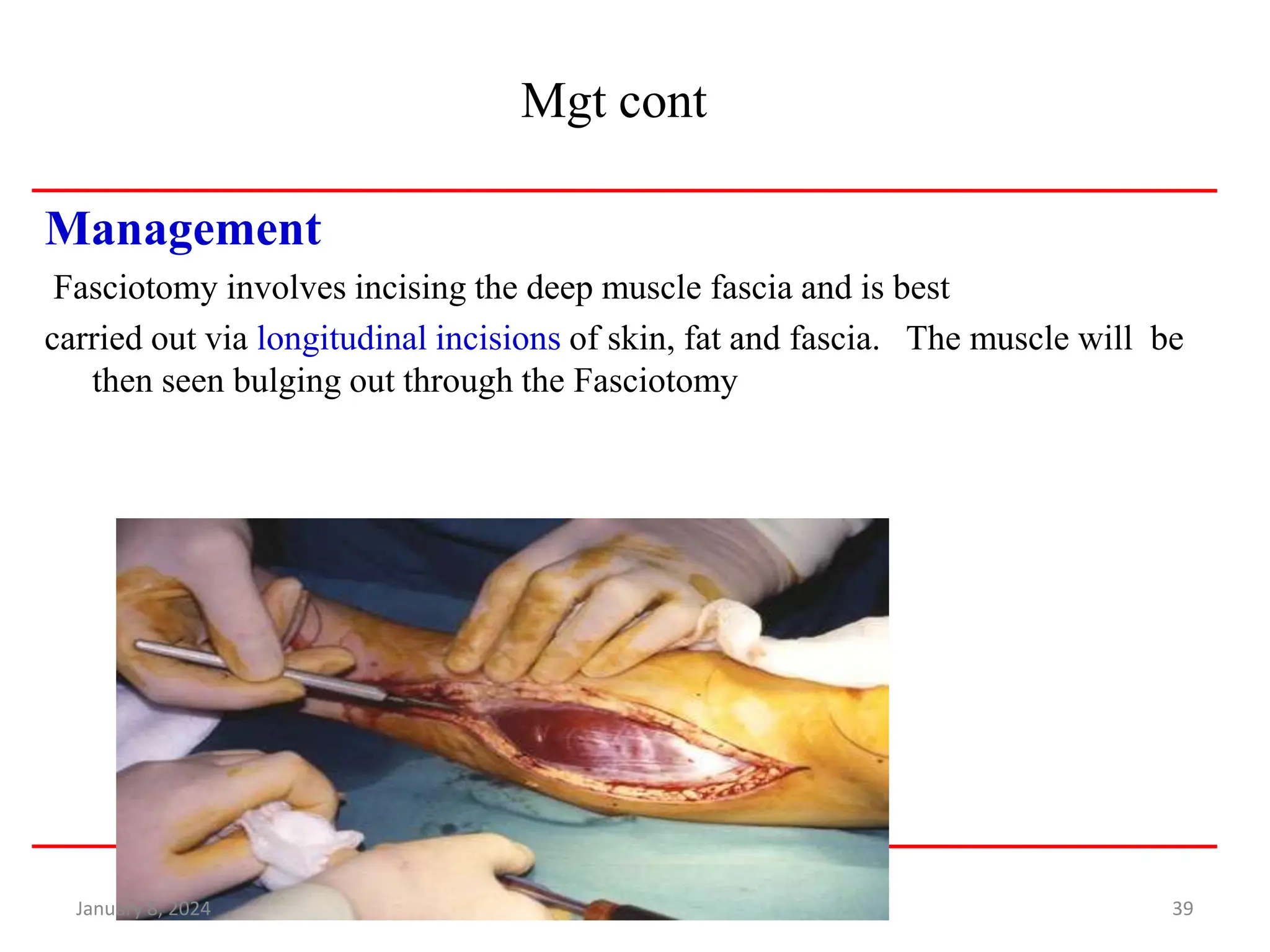 Emergency wound Mgt | PPTX