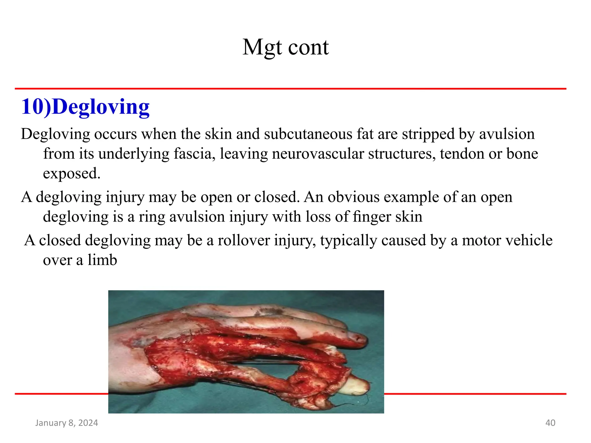 Emergency wound Mgt | PPTX