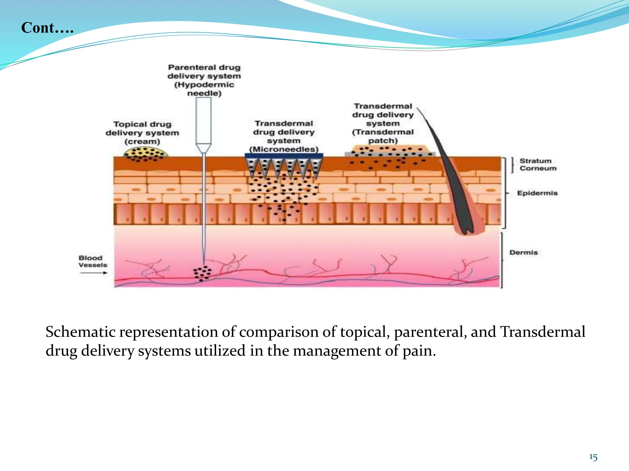 “EMERGING TRENDS IN TRANSDERMAL DRUG DELIVERY TECHNOLOGIES”.pptx