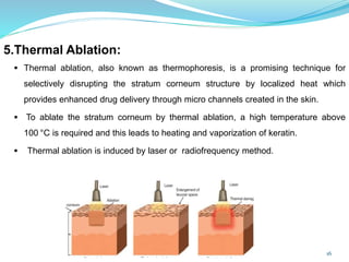 “EMERGING TRENDS IN TRANSDERMAL DRUG DELIVERY TECHNOLOGIES”.pptx