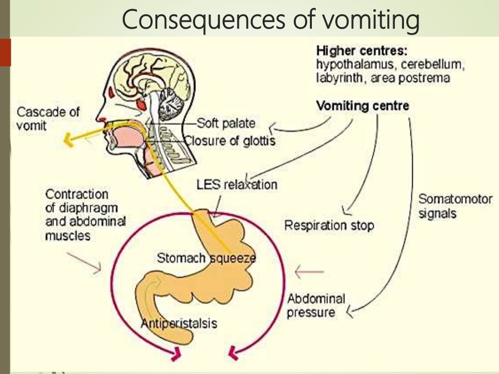 Emesis & anti emetics medications