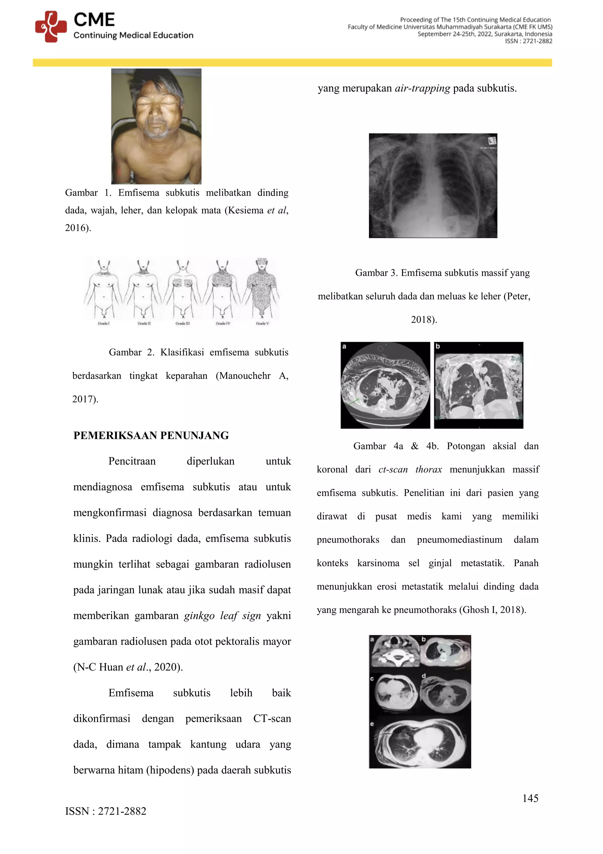Emfisema subkutis.pdf