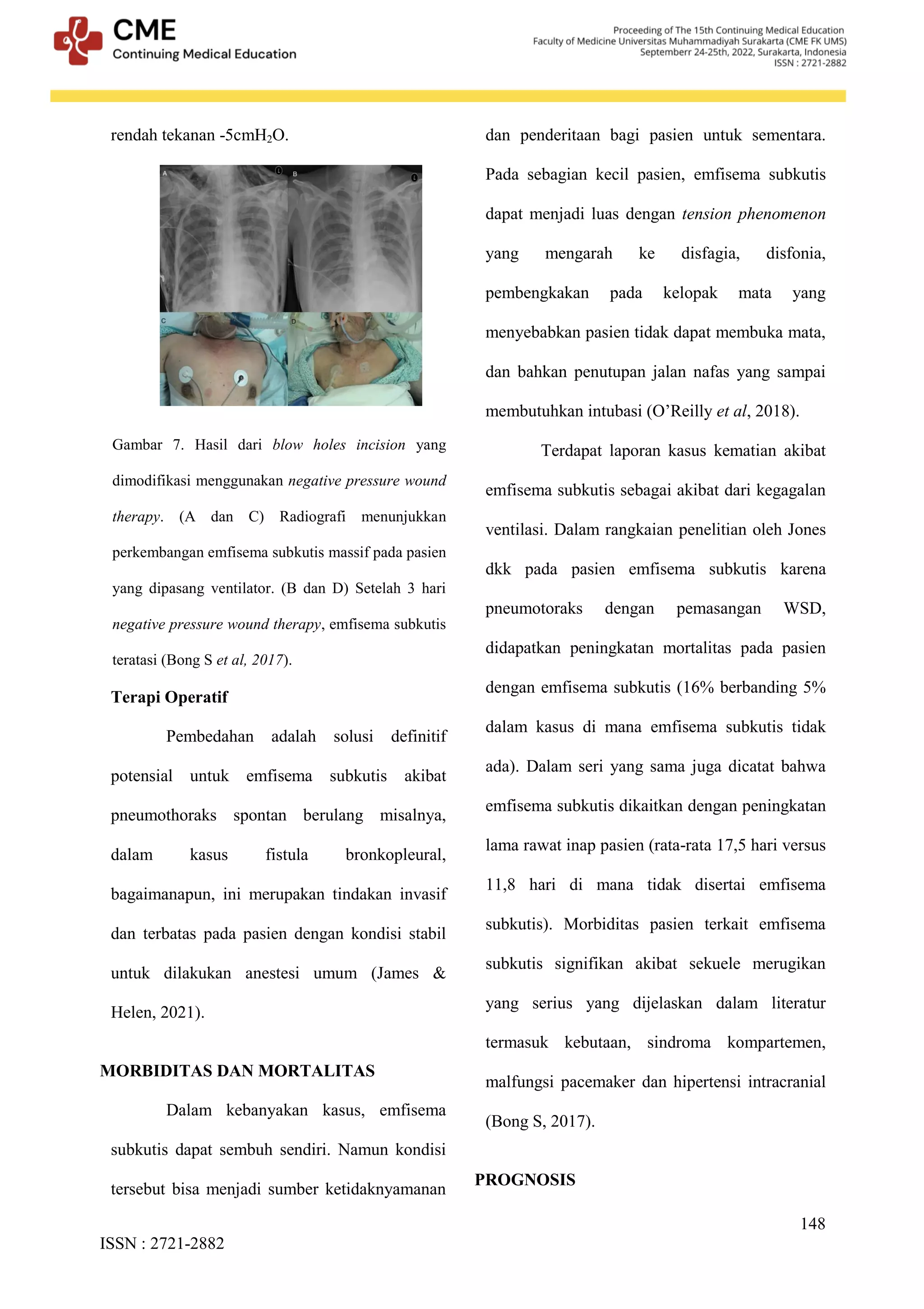 Emfisema subkutis.pdf