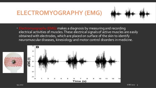 Electromyography (EMG)