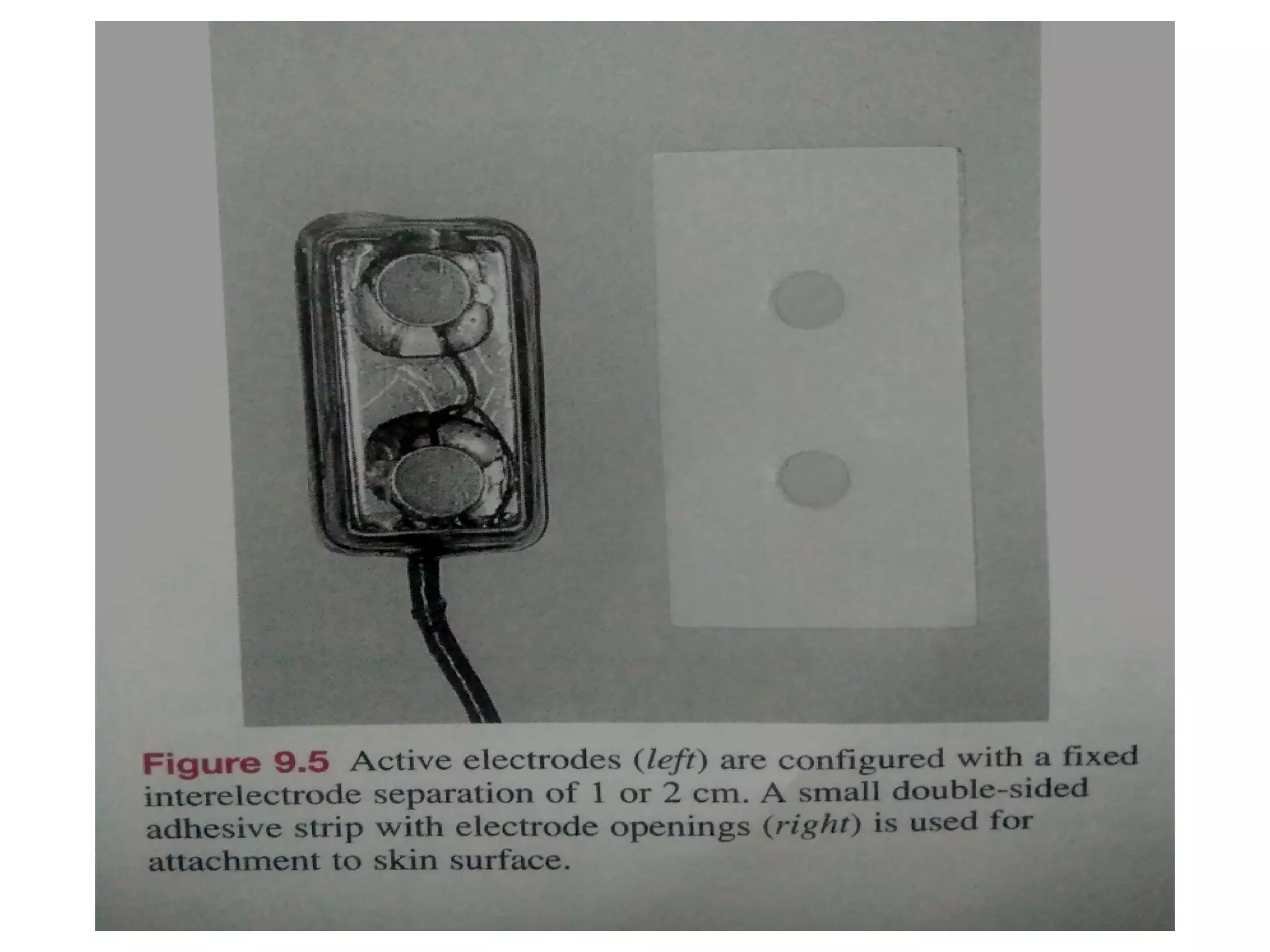 Emg | PDF