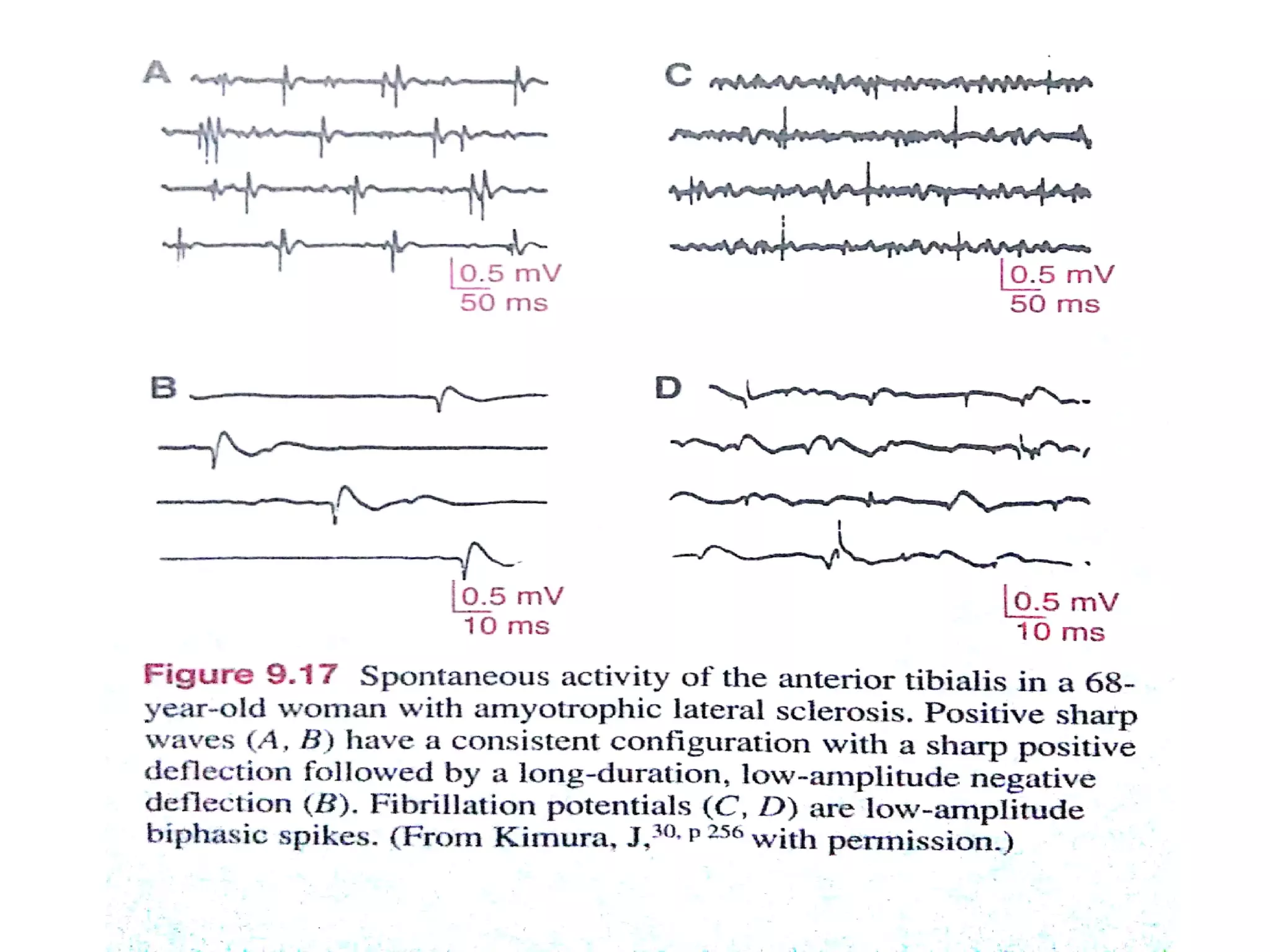 Emg | PDF
