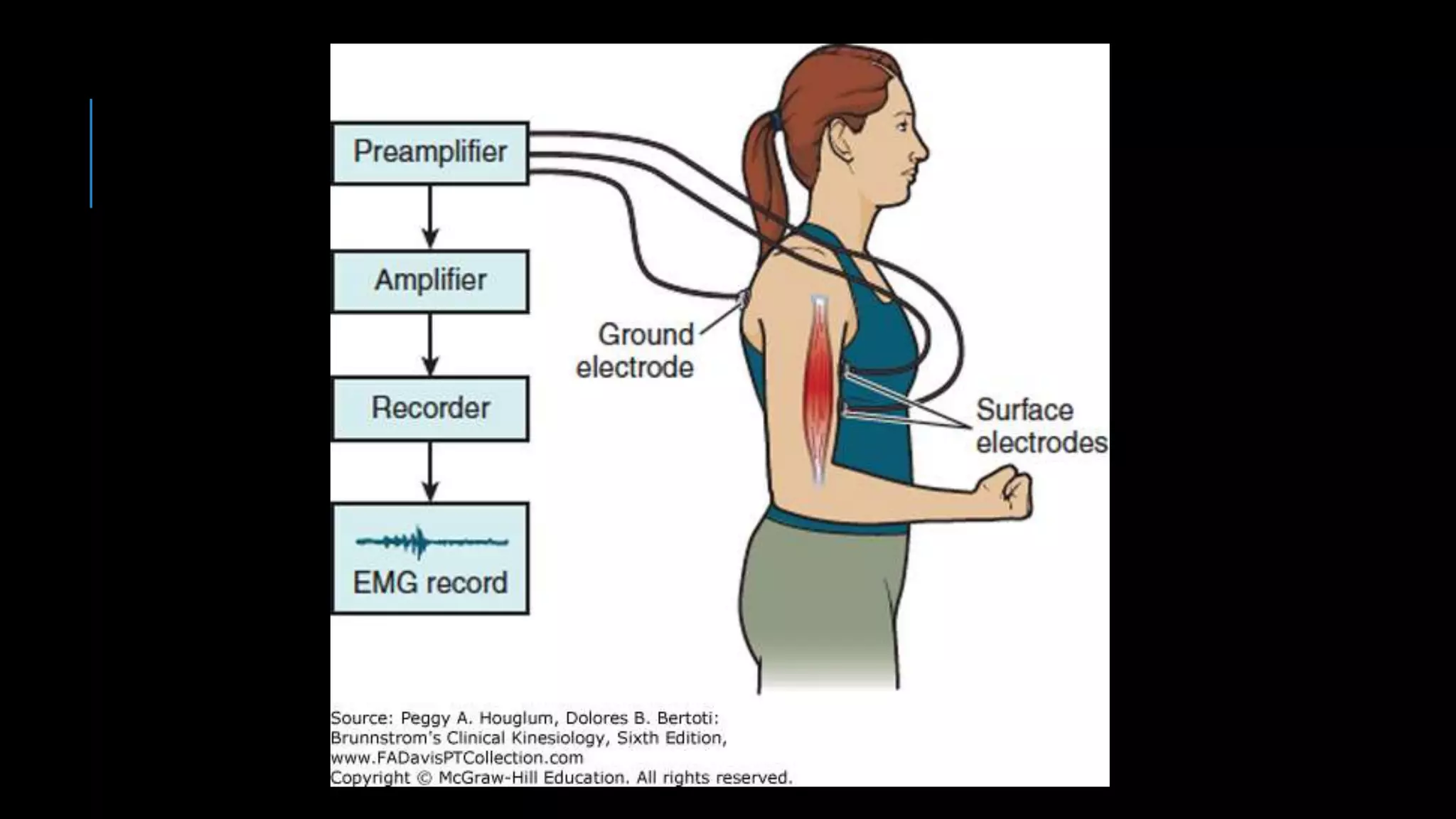 Electromyography (EMG) | PPTX