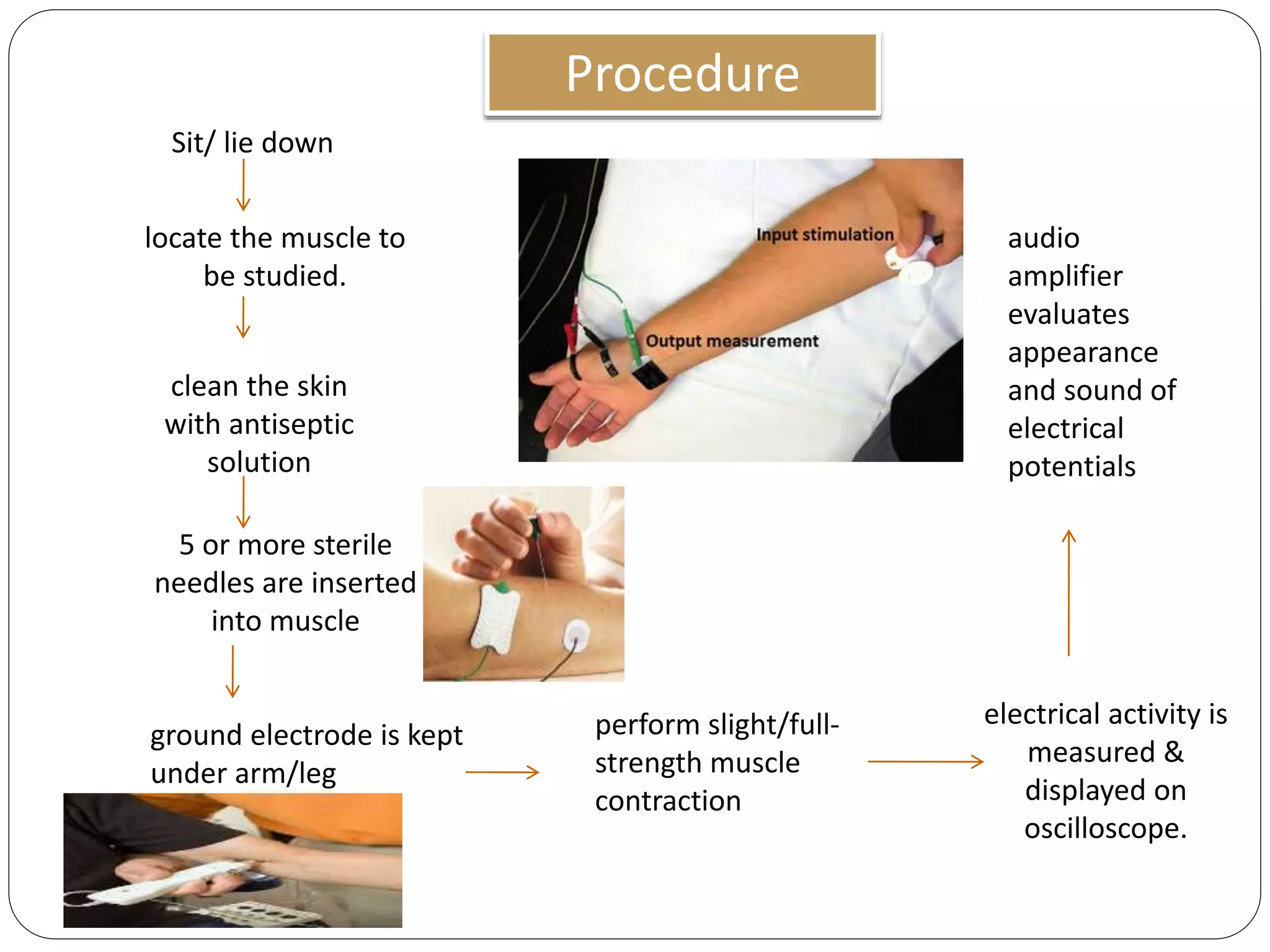 Electromyography | PPTX