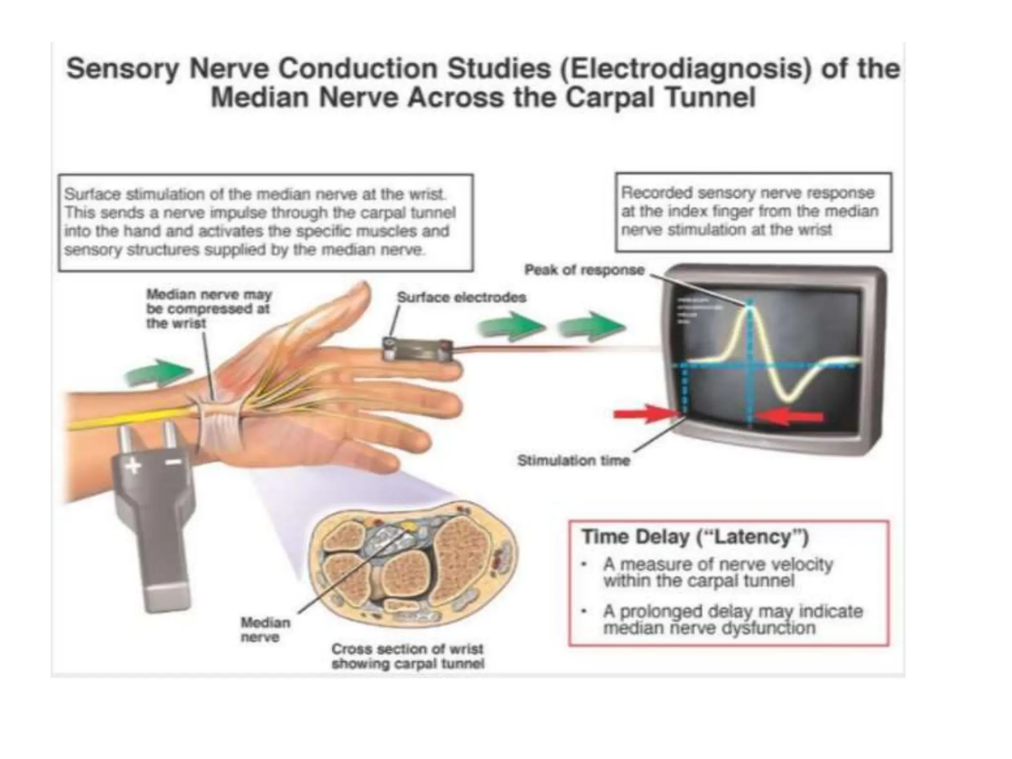electromyography purpose ,prepration,working pptx | PPT