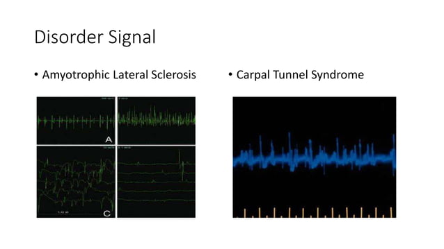 EMG project by BME student, funny project.pptx