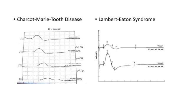 EMG project by BME student, funny project.pptx