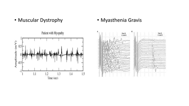 EMG project by BME student, funny project.pptx