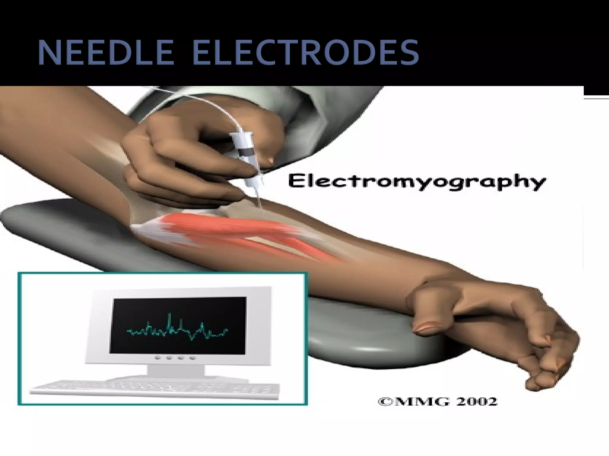 Emg biofeedback | PPT