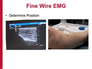 EMG | PPTX